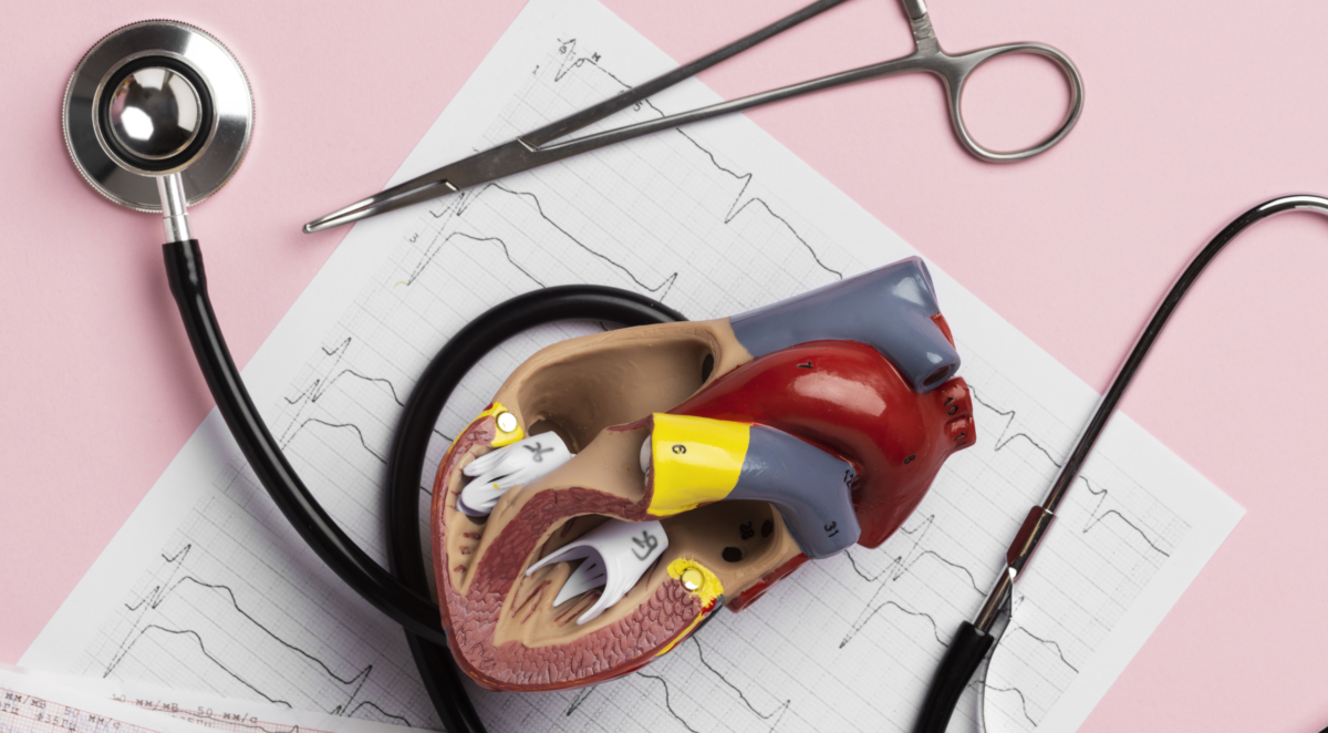 Effective Strategies on How to Shrink an Aortic Aneurysm Naturally